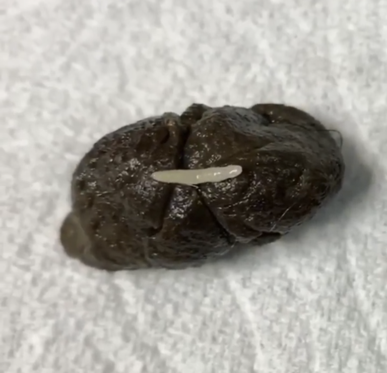Dipylidium caninum, The "Flea Tapeworm" of Dogs and Cats: Everything ...